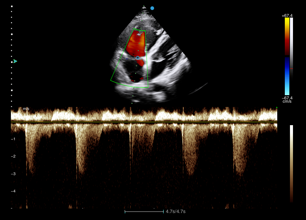 APOGEE 5300 ELITE ⋆ Equipos Médicos UltraTechnical